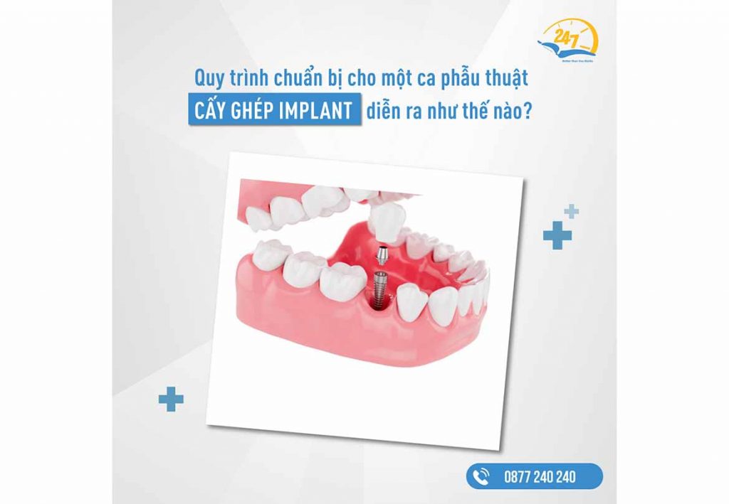 Quy trình chuẩn bị cho một ca phẫu thuật cấy ghép implant